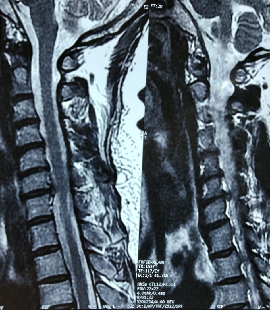 Dr. Saikat Sarkar - Orthopaedic Spine Surgeon