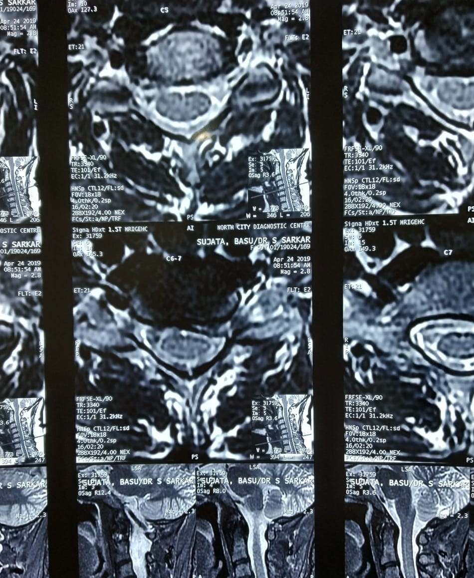 Dr. Saikat Sarkar - Orthopaedic Spine Surgeon